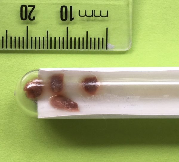 Liver biopsy sampling - Awanui Veterinary