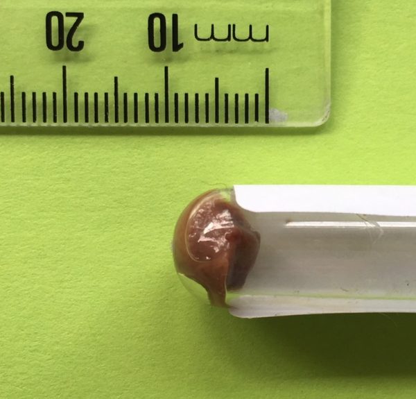 Liver biopsy sampling - Awanui Veterinary