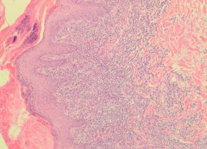 Histopathology – Necropsy samples - Awanui Veterinary