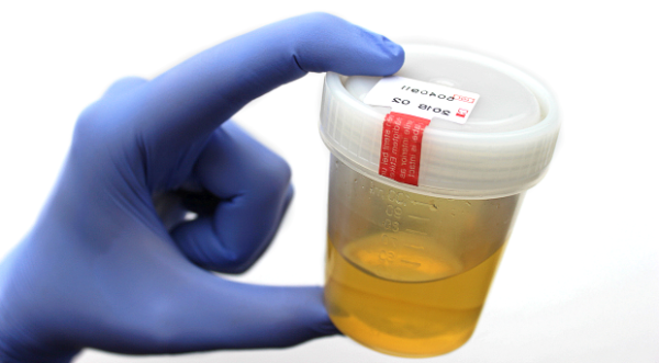 Urinalysis - urine sediment examination - Awanui Veterinary