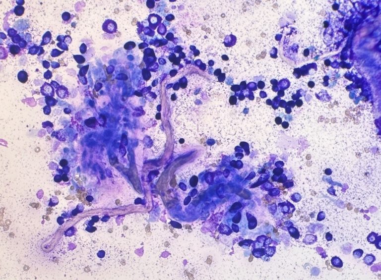 Cytologic grading of canine mast cell tumours - Awanui Veterinary