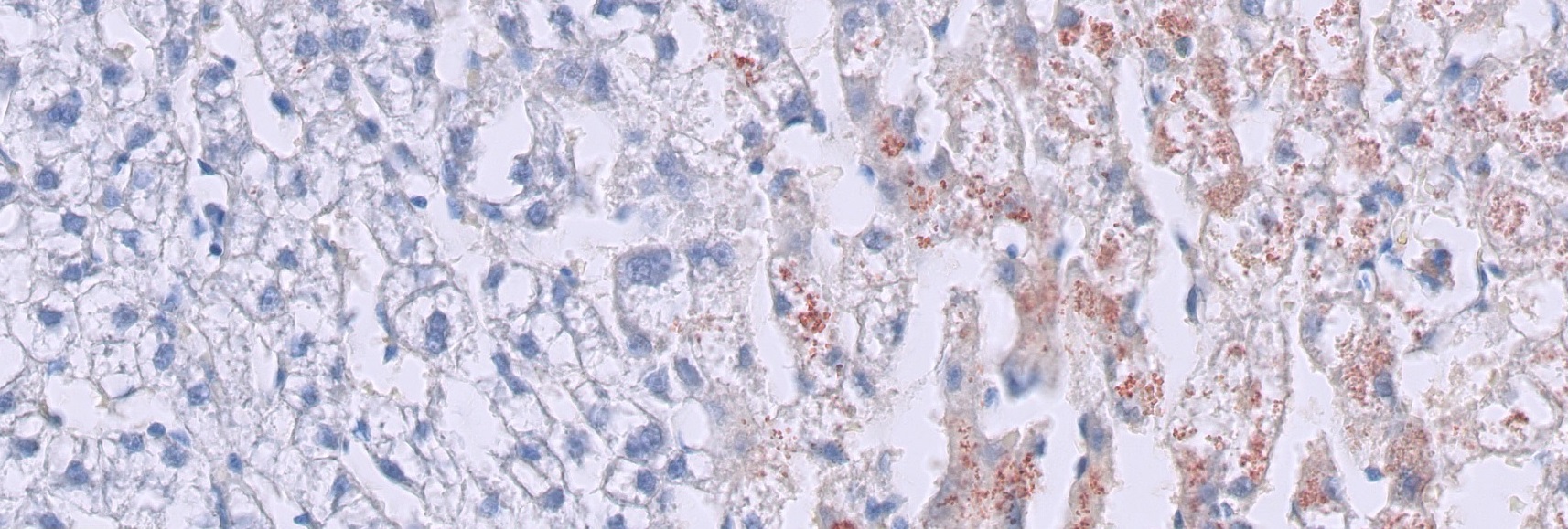 Companion animal liver biopsies - Awanui Veterinary